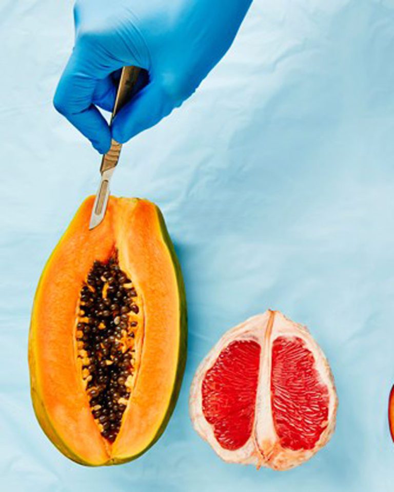 The Benefits of a Labia Fat Transfer For Feminine Rejuvenation